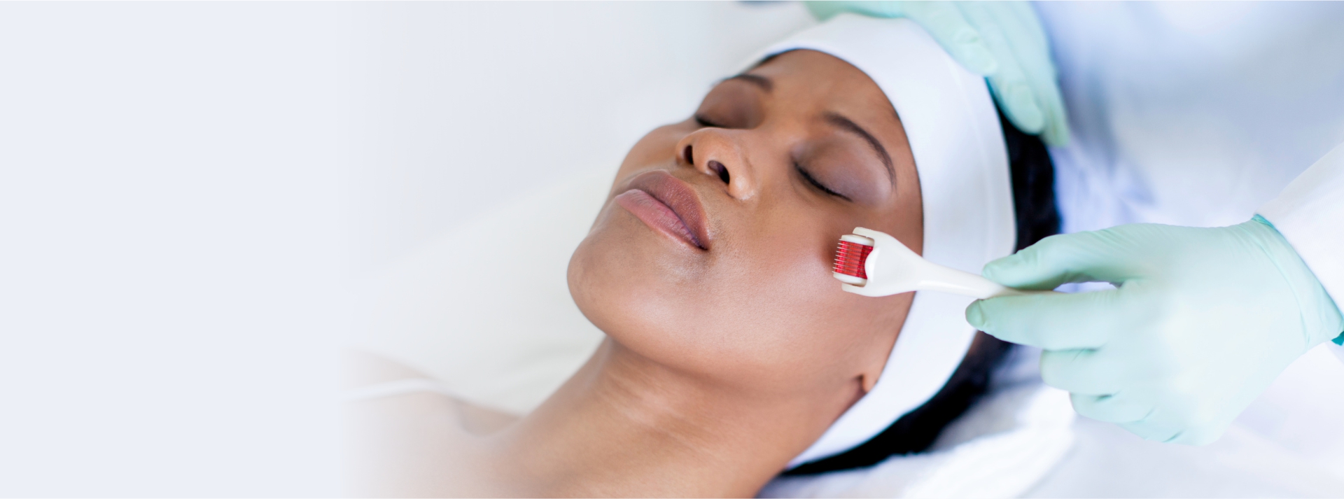 Microneedling for skin tightening - Medicare